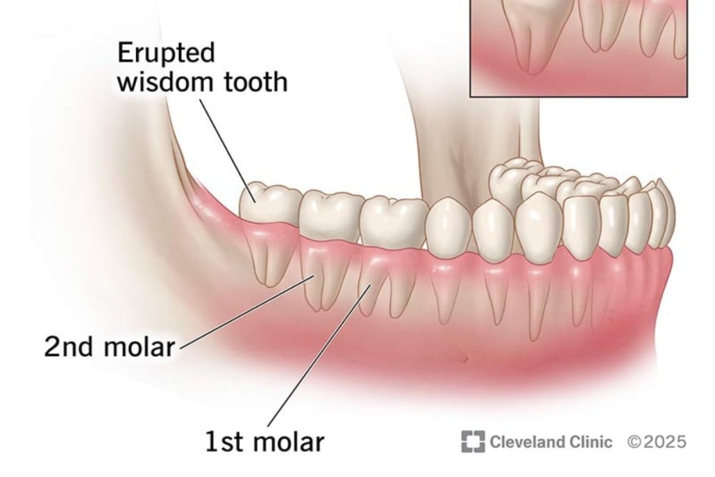 Terapi Myofungsional: Cara Merawat Gigi Anak Tanpa Kawat Gigi yang ...